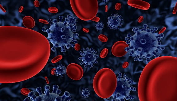 #Câncer associado ao HIV: sarcoma de Kaposi (parte 1) « maismaismedicina