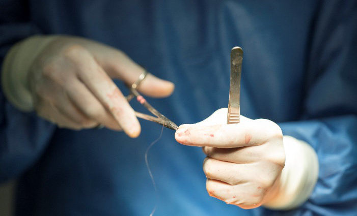 Aprenda a abordar a deiscência de feridas de parede abdominal - PEBMED