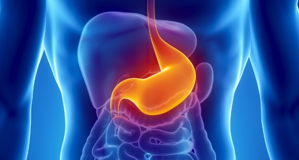 Gastrectomia laparoscópica é uma boa opção para o câncer gástrico? - PEBMED