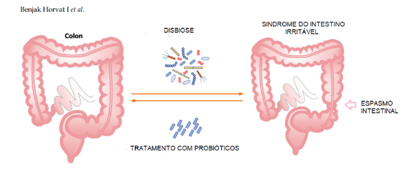 Os probióticos podem melhorar os sintomas da síndrome do intestino ...